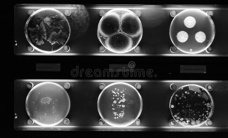 Different Samples with Kinds of Bacterias Living at Common Household ...