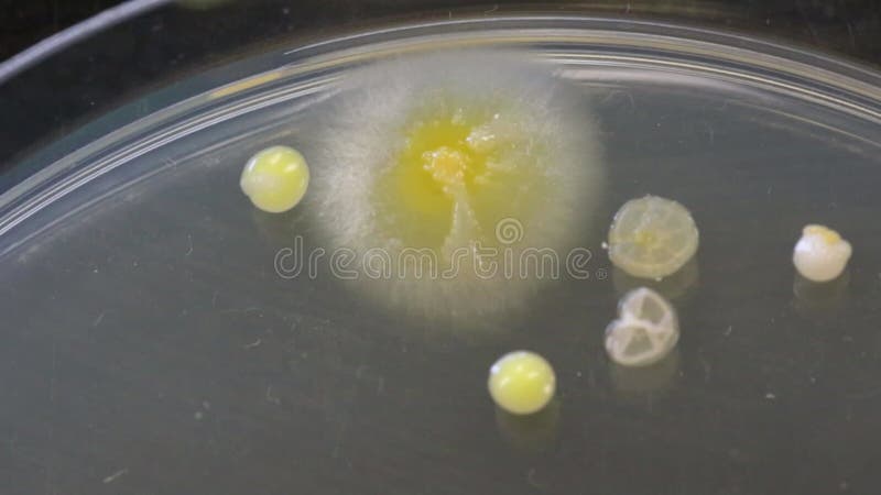 Shapes of Microbial Colonies Stock Video - Video of college, growing ...