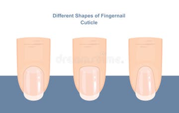 Different Shapes of Fingernail Cuticles. Manicure Guide. Vector Stock ...