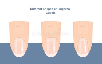 Different Shapes of Fingernail Cuticles. Manicure Guide. Vector Stock ...