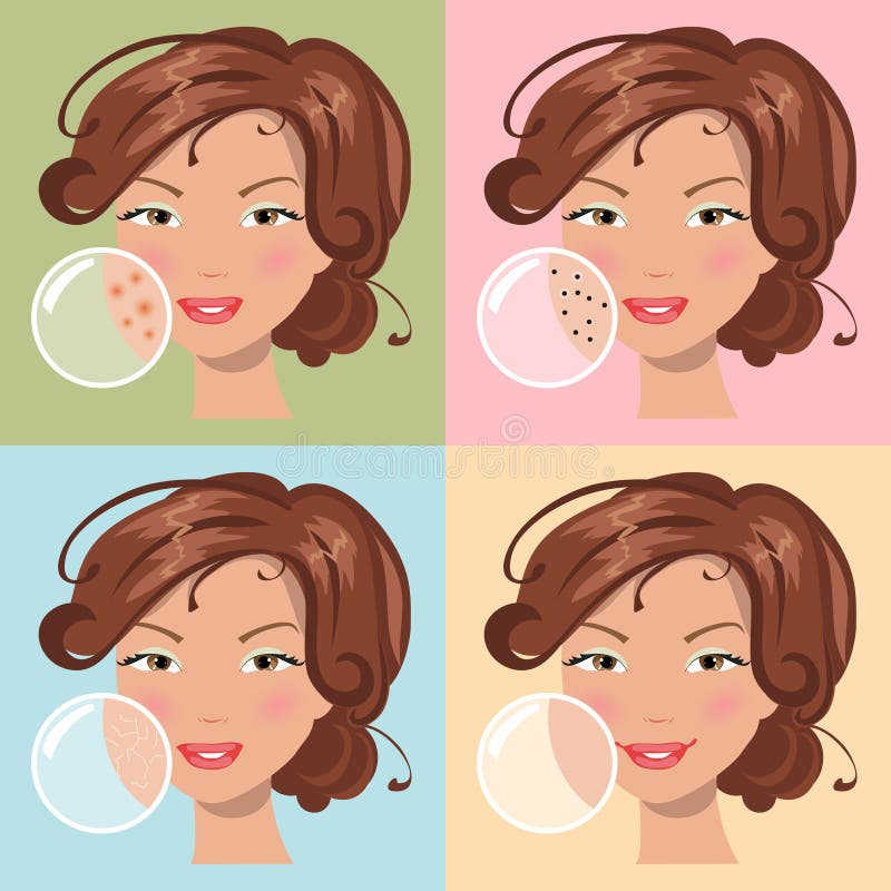 Different Skin Problems. Vector Illustration Stock Vector ...