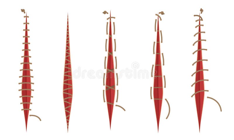 Different Surgical Stitches Isolated on White Background Vector Set ...