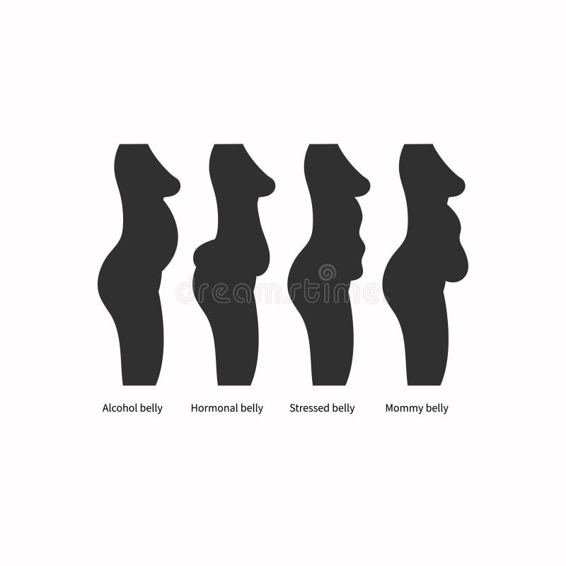 6 Types of Obesity. Male and Female Figure in Profile. Stock Vector ...