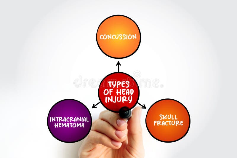 Different Types of Head Injury, Mind Map Text Concept for Presentations ...