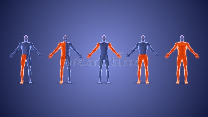 Different Types of Paralysis Condition Medical Concept Stock ...