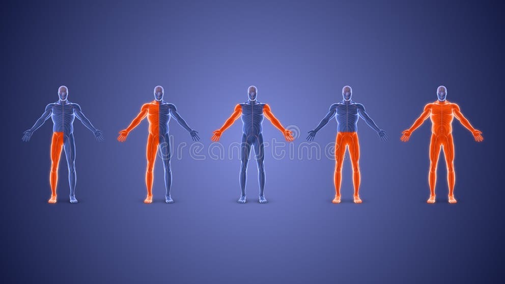 Types Paralysis Stock Illustrations – 13 Types Paralysis Stock ...