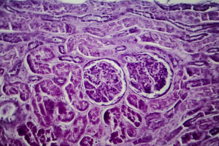 321 Lupus Erythematosus Stock Photos - Free & Royalty-Free Stock Photos ...