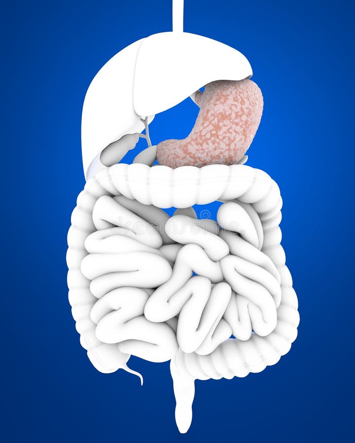 Digestive Tract, Stomach and Ulcers, Stock Illustration - Illustration ...