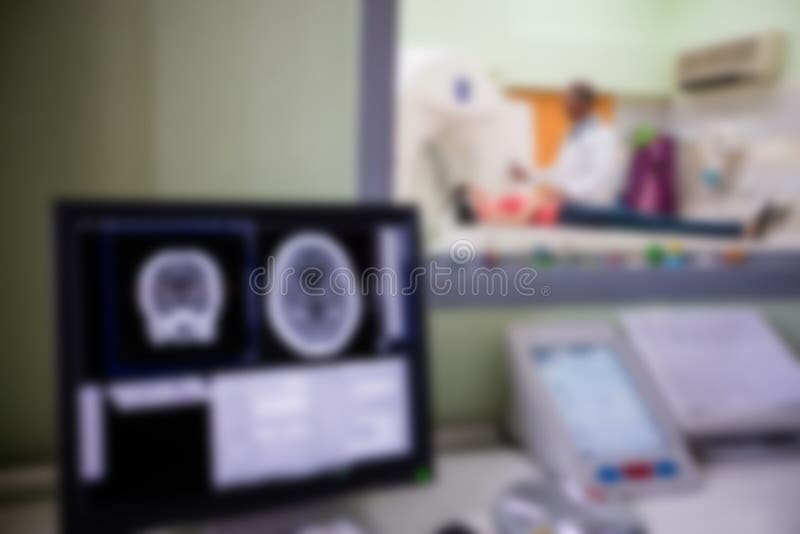 Digital Brain Scan on Computer Monitor Stock Photo - Image of people ...