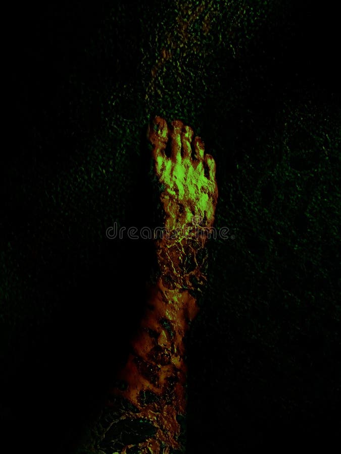 Digital Collage and Special Processing. Leg that Rot. Green, Brown and ...