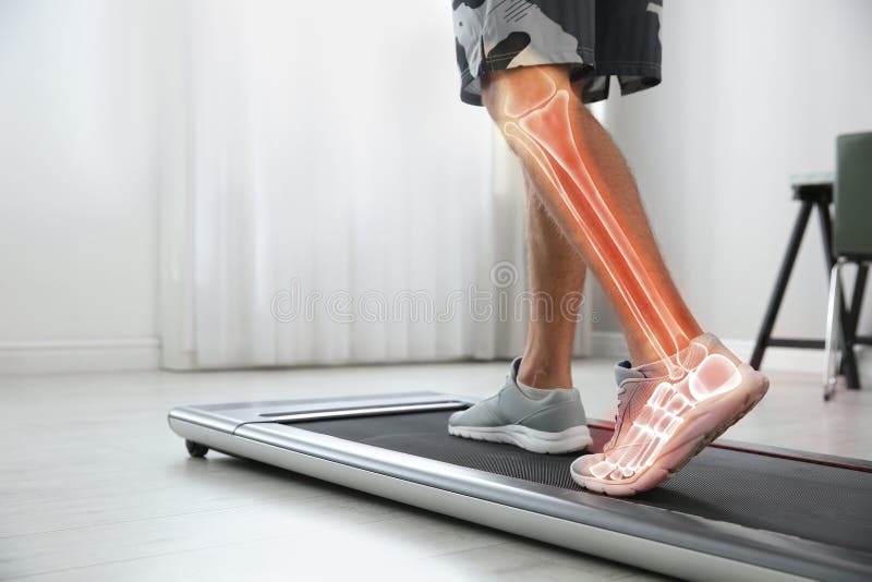Digital Composite of Highlighted Bones and Man Training on Walking ...
