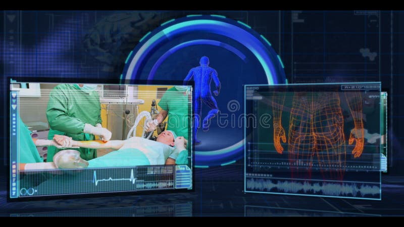 Digital Medical Interface Showing Various Surgical Clips Stock Footage ...