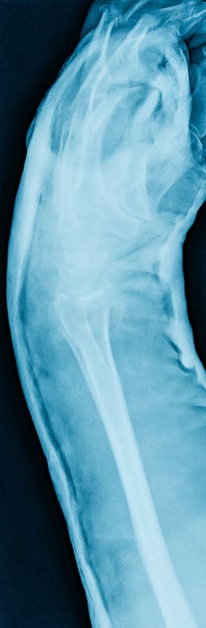 Digital Radiography of Arm and Hand. X Ray of Left Side Stock Image ...