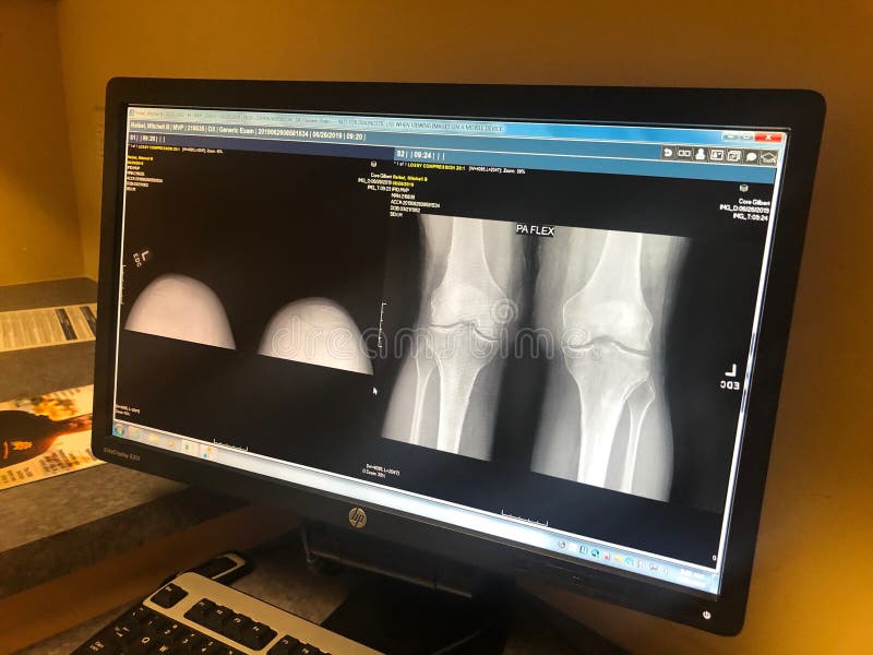 Digital X-Ray editorial photo. Image of digital, computerscreen - 154223041