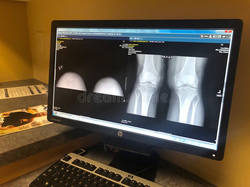 Digital X-Ray editorial photo. Image of screen, xray - 154223046