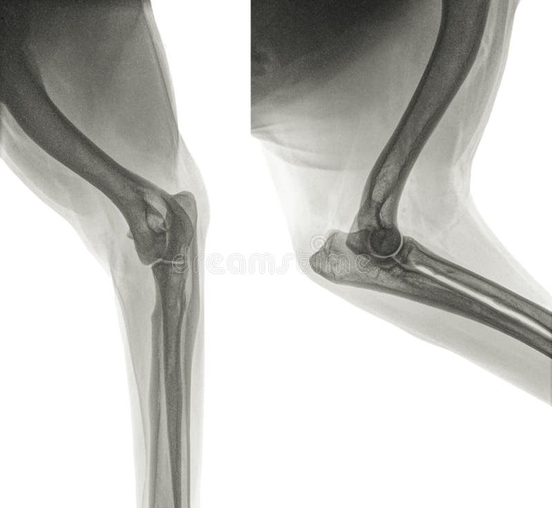 Elbow Flexion Anatomy Stock Photos - Free & Royalty-Free Stock Photos ...