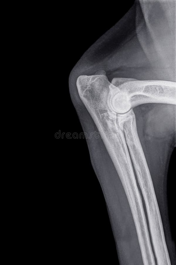 Digital X-ray of the Normal Elbow of a Dog Stock Photo - Image of anima ...
