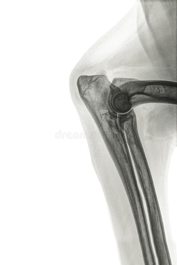Digital X-ray of the Normal Elbow of a Dog Stock Photo - Image of anima ...