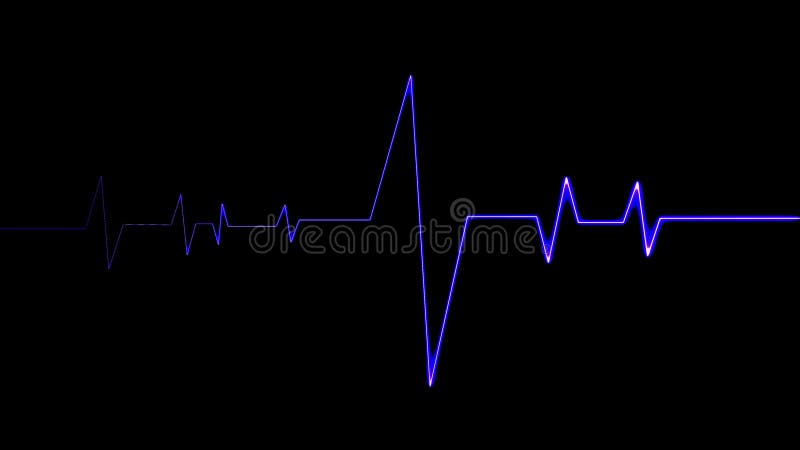 Vibrant Blue Electrocardiogram Waveform Pulsing Against a Stark Black ...