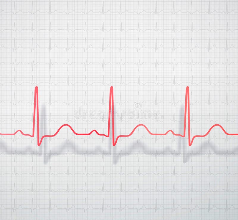 Dimensional ECG Line with Shadow on the Graph Paper Stock Illustration ...