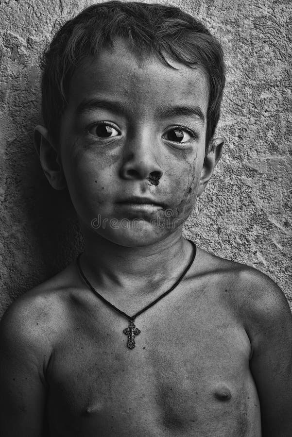 Dirty Boy On A Background Of Gray Wall With An Expression Of Despair On ...