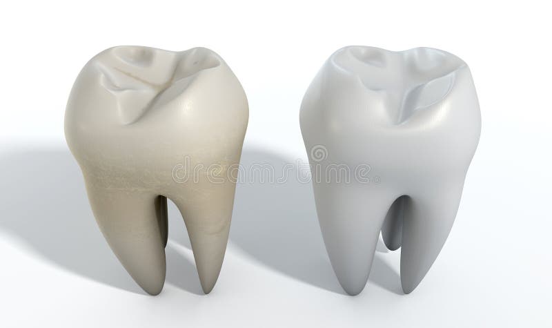 Dirty Clean Tooth Comparison Stock Photo - Image of orthodontics ...