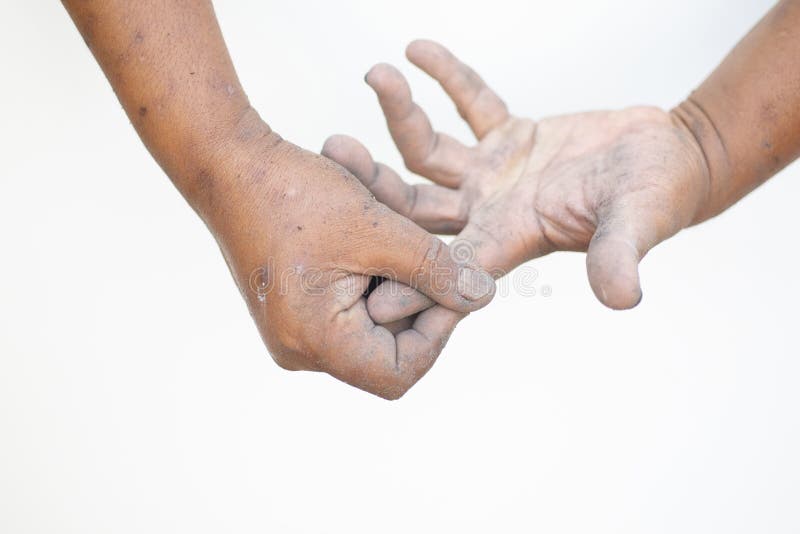 Dirty Finger and Hand Gesture on Both Hand Stock Photo - Image of ...