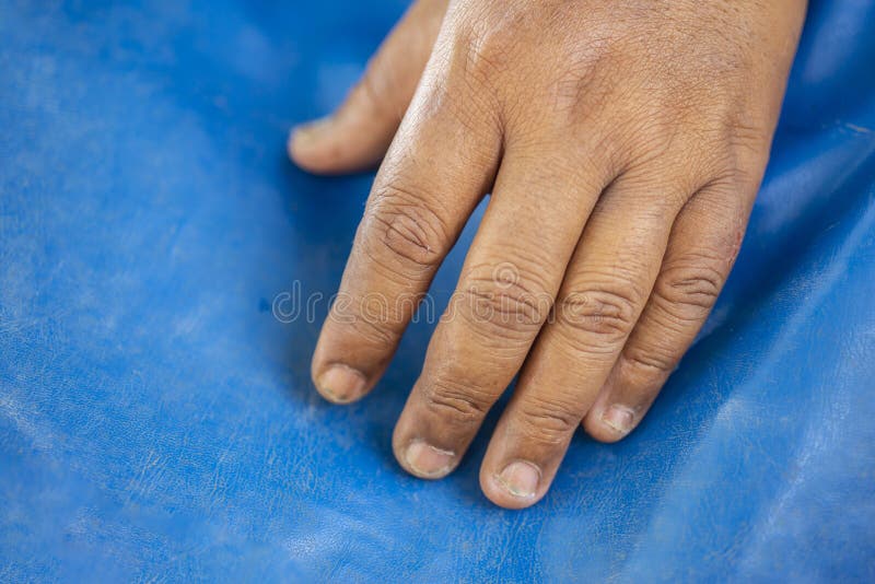Dirty fingers and dry skin stock photo. Image of concept - 328598106