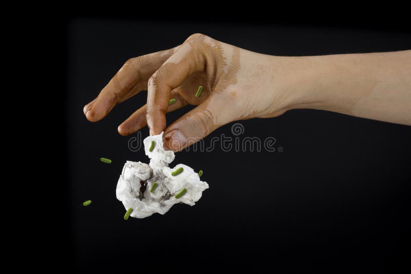 Dirty hand stock image. Image of infection, parasite - 122782213