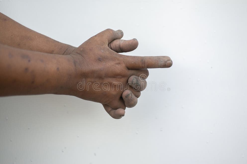 Dirty Hand Gesture Gesture Pointing Finger Stock Image - Image of ...