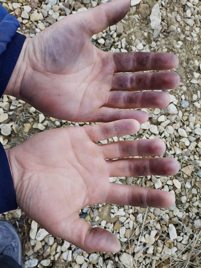The Dirty Hands of the Worker on the Construction Site Stock Photo ...
