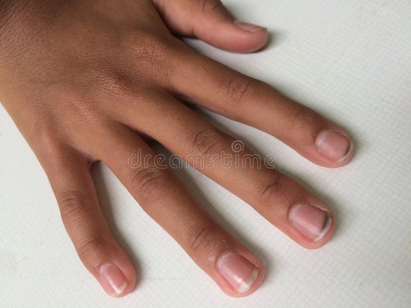 Dirty Long Nails Have Germs Make Sick. Stock Image - Image of caucasian ...