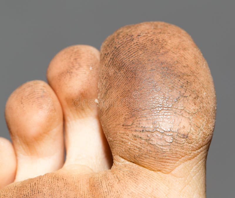 Dirty Foot on a White Background Stock Photo - Image of dirty, white ...