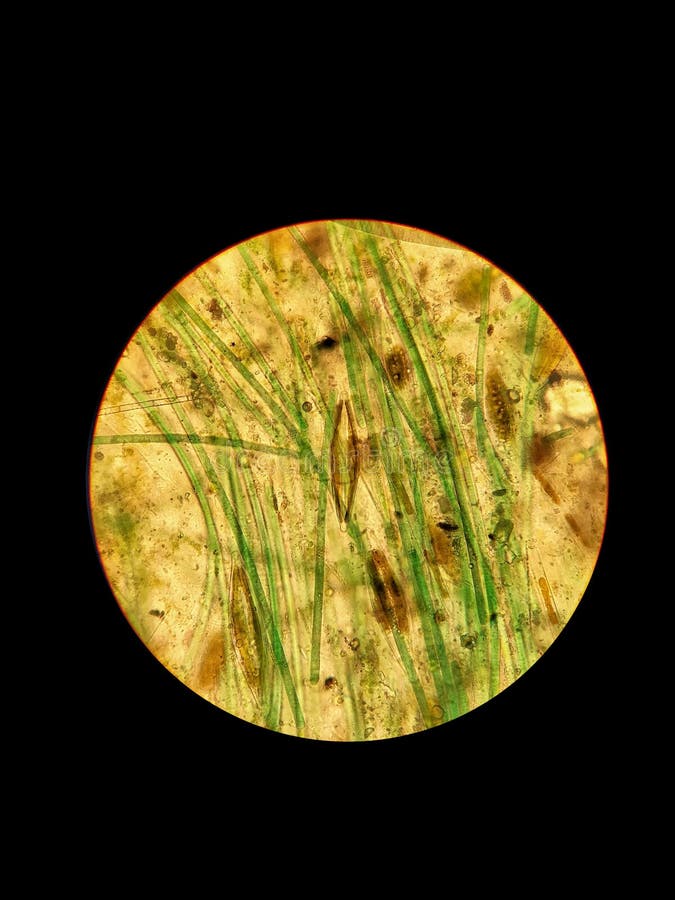 Dirty Water Sample Under a Microscope. Stock Photo - Image of diatoms ...