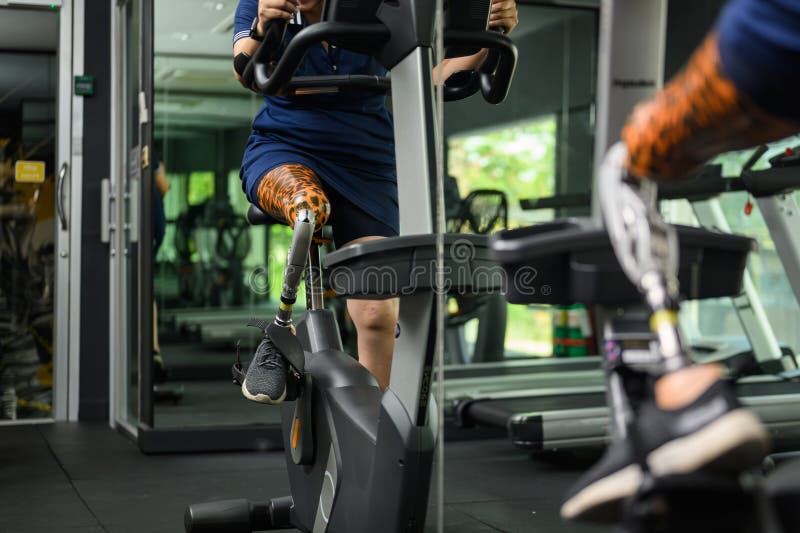 Disabled Athlete Patient with Prosthetic Leg Doing Exercise at Gym ...