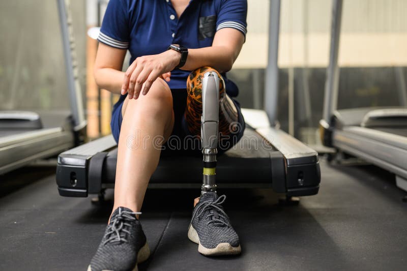 Disabled Athlete Patient with Prosthetic Leg Doing Exercise at Gym ...