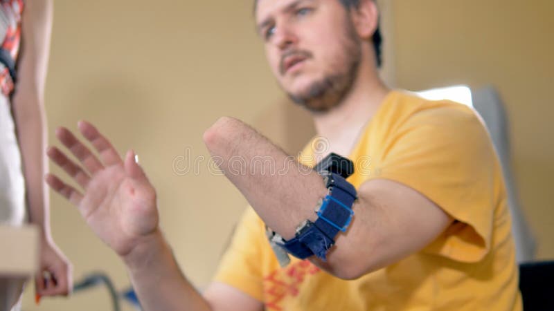 Disabled Man with the Amputated Arm. Wireless Sensor for Bionic ...