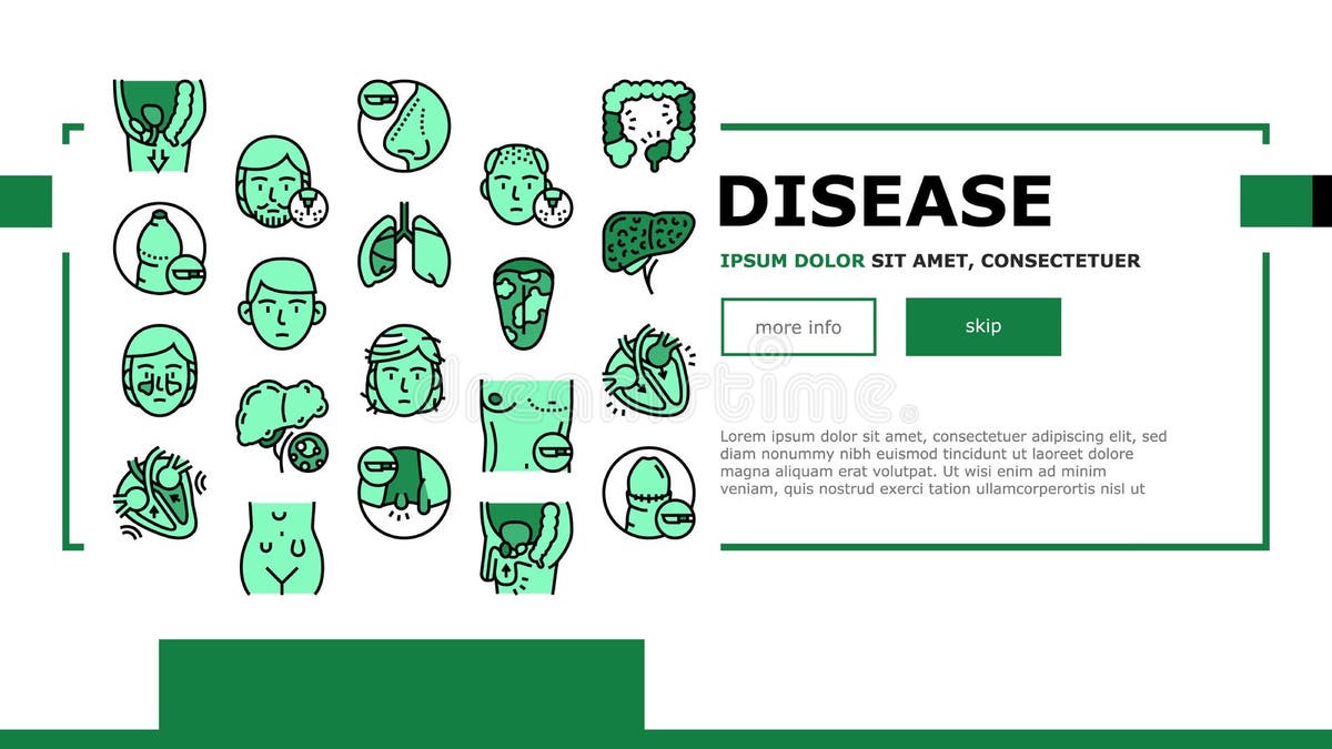 Cryptorchidism Stock Illustrations 100 Cryptorchidism Stock