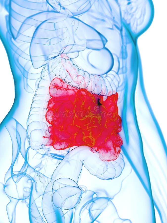 A diseases small intestine stock illustration. Illustration of enteric ...