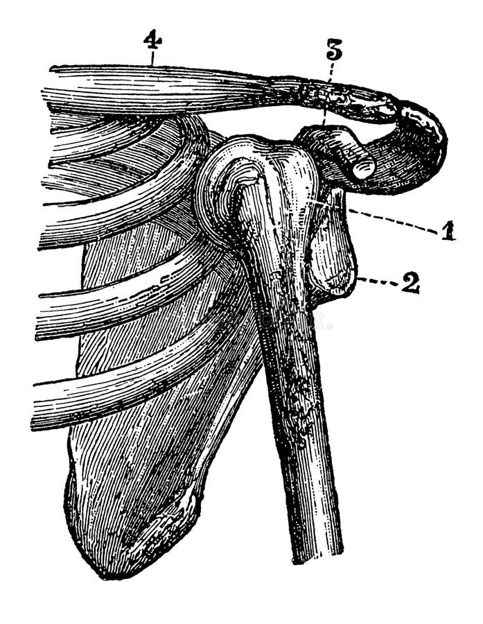 Shoulder Dislocation. Anterior Dislocation. Posterior Dislocation ...