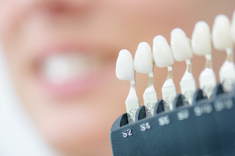 Display of Artificial Teeth Stock Photo - Image of choice, specific ...