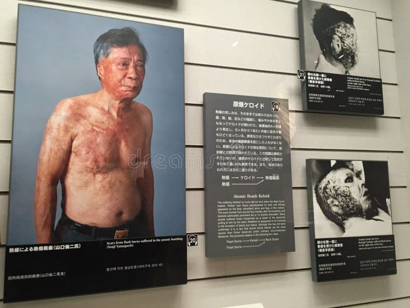 Display in Nagasaki Atomic Bomb Museum Editorial Image - Image of ...
