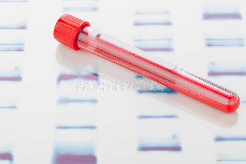 DNA profile and pipette stock image. Image of person - 13344953