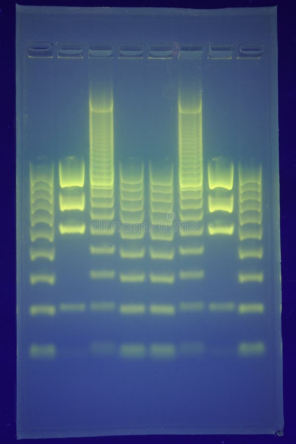 DNA Gel Electrophoresis stock photo. Image of hands, experiments - 2223462