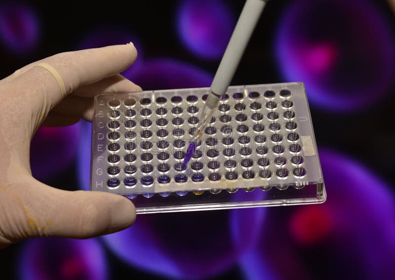 DNA Testing in the Laboratory. Stock Image - Image of dose, equipment ...