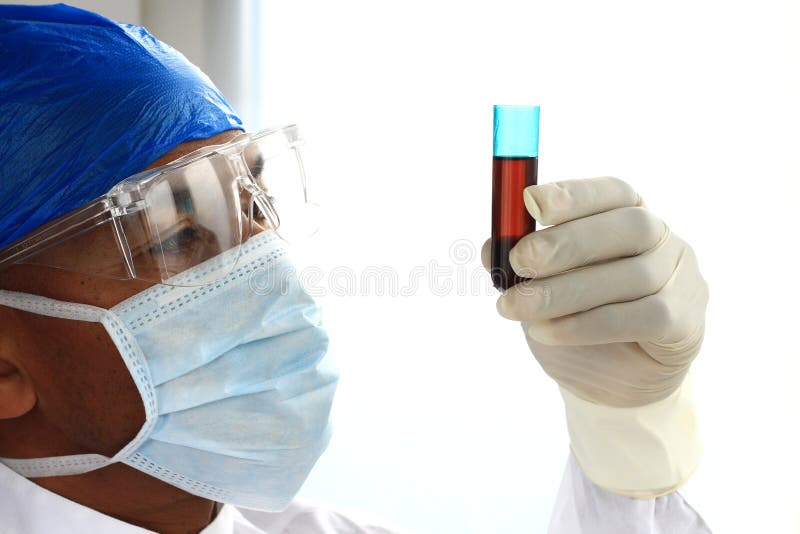 Close Up of Young African Doctor Hand Bleeding Making Hiv and Sida Test ...