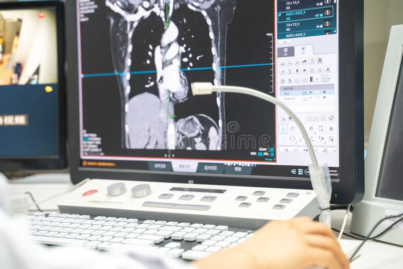 Doctor Analyzing the Test Results from MRI Scanner on the Computer ...