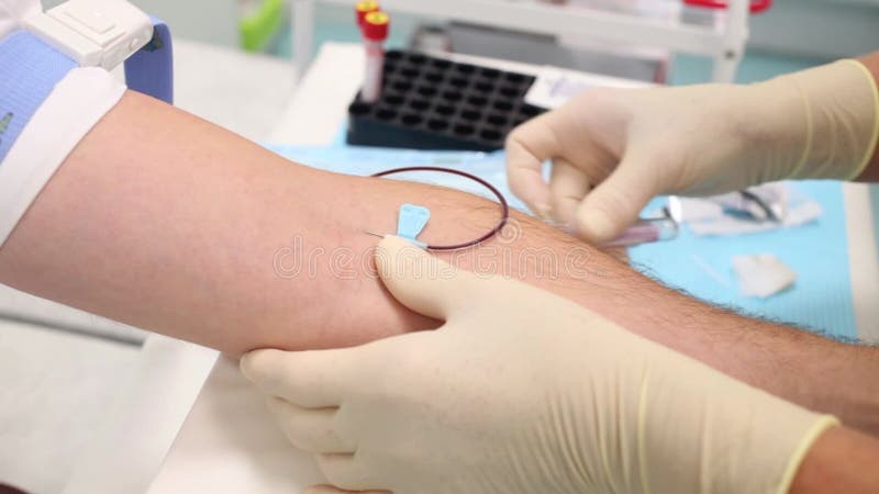Doctor is Blood Sampling of Man and Change Test Stock Footage - Video ...