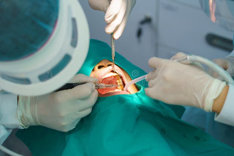 Doctor Cleaning the Teeth Patient with Ultrasonic Tool Stock Photo ...