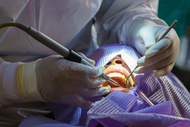 Doctor Cleaning the Teeth Patient with Ultrasonic Tool Stock Image ...
